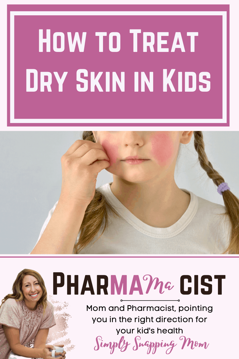 Ultimate Guide to Treating Dry Skin in Kids - Simply Rooted Family